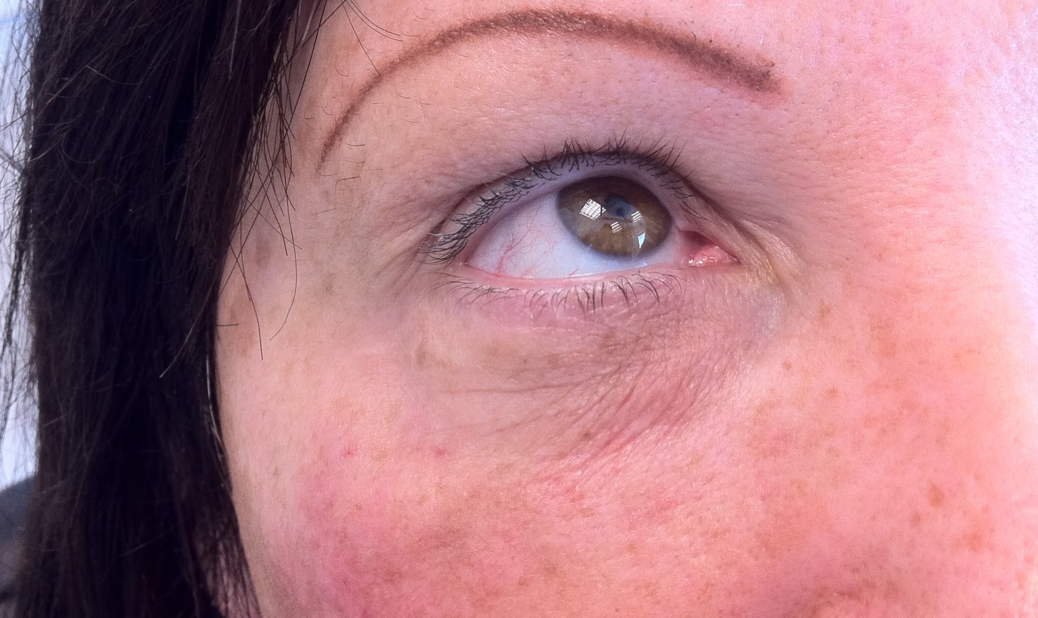 Disguising Tear Troughs, finally something that works..