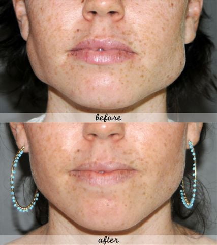 Emma Preston - the Skin Clinic